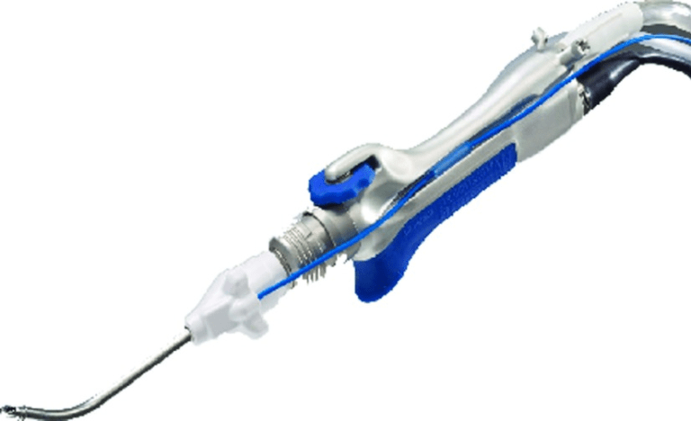 Tonsillectomy: Guide to Modern Approaches and Instruments – Dr. Ameen ...